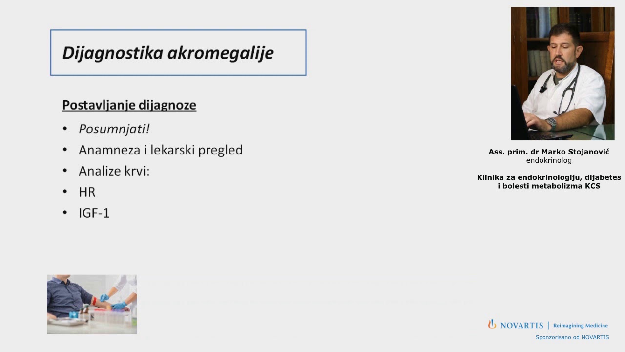 Dijagnostika akromegalije - Ass dr Marko Stojanović - PharmaMedica