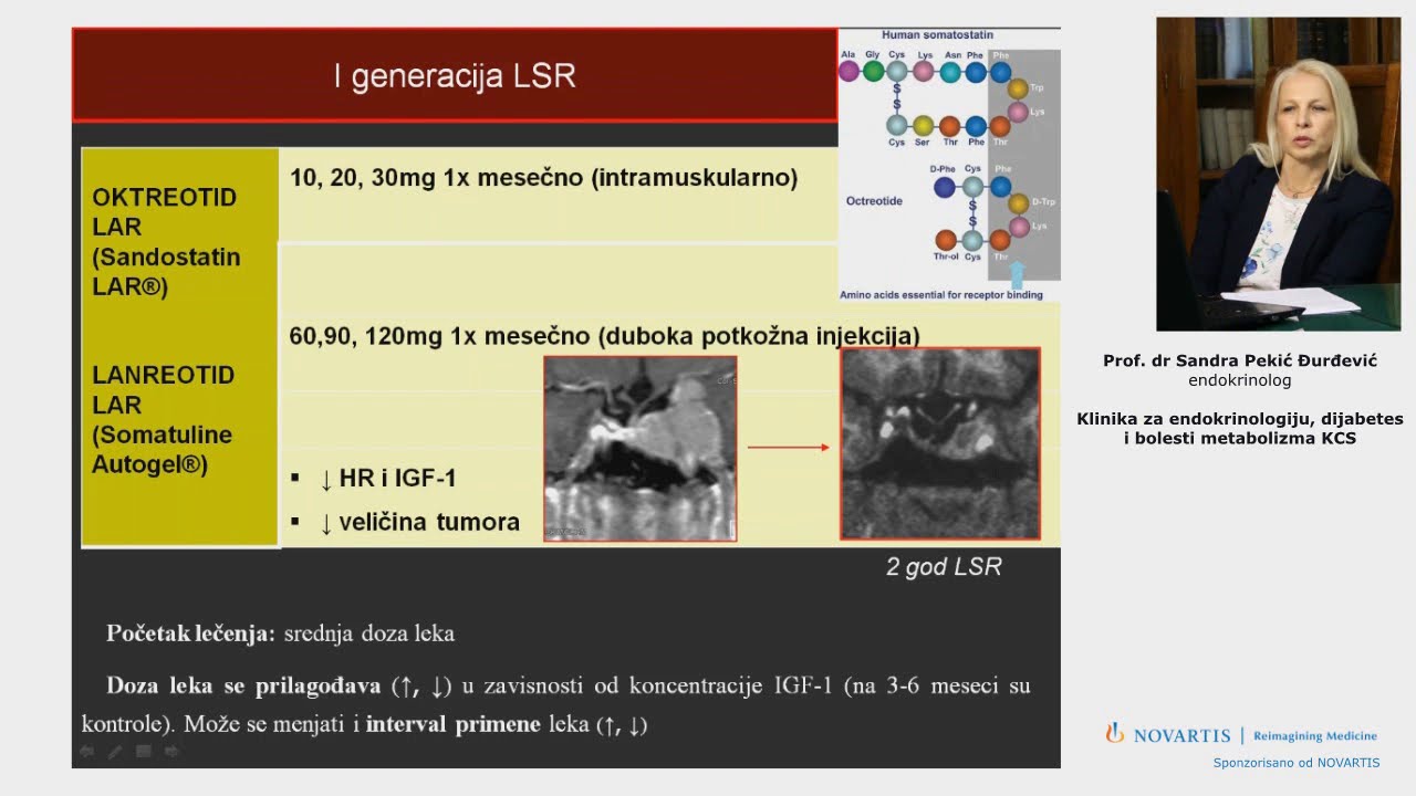 Lekovi u akromegaliji – Prof dr Sandra Djurdjević - PharmaMedica